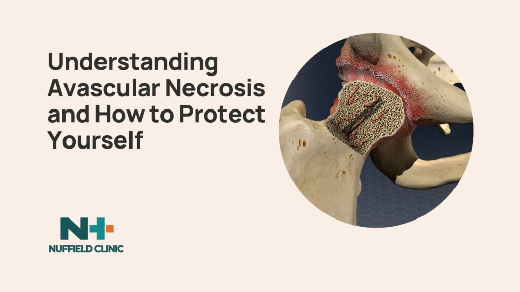 What is Avascular Necrosis and How do You to Protect Yourself ...