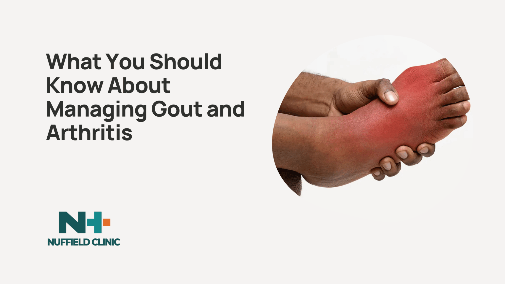 What You Should Know About Managing Gout and Arthritis - Nuffield Clinic