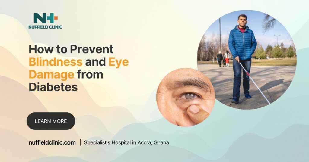How to Prevent Blindness and Eye Damage from Diabetes - Nuffield Clinic